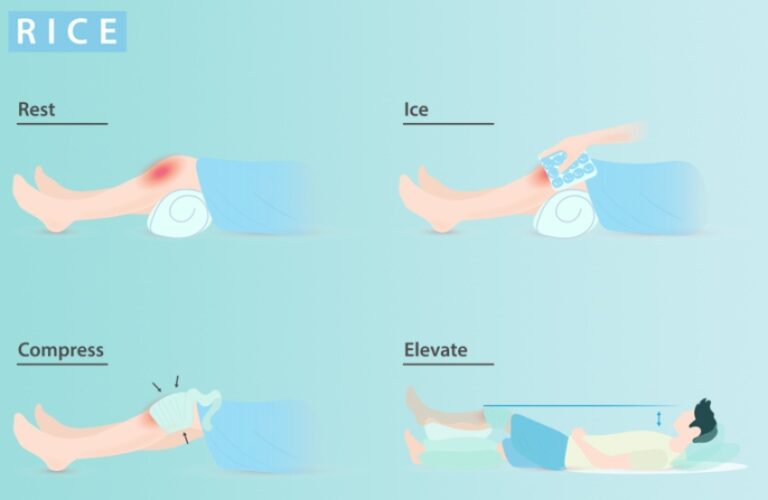 Phương Pháp RICE Trong Sơ Cứu Chấn Thương Thể Thao Chuẩn
