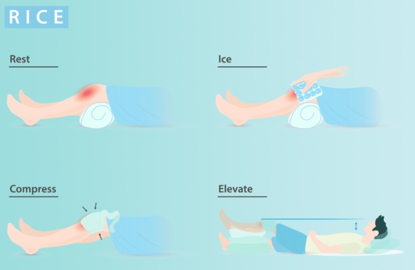 Phương Pháp RICE Trong Sơ Cứu Chấn Thương Thể Thao Chuẩn